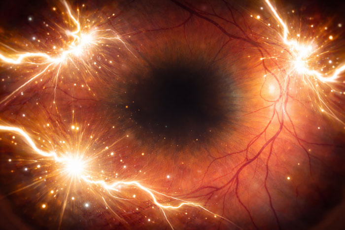 Eye Floaters and Flashes: Causes, Symptoms, and Next Steps