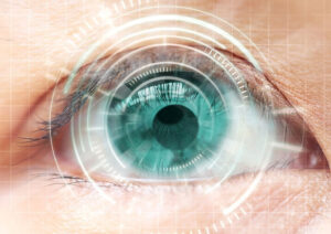 Selective Laser Trabeculoplasty (SLT): Glaucoma Treatment - Vantage Eye ...